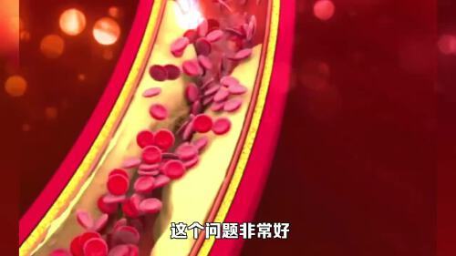 你的心脑血管还好吗?有没有粥样硬化?教你一个简单自测方法