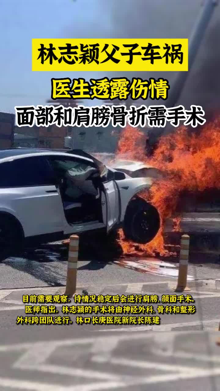 医生透露林志颖伤势,目前人已清醒,多处受伤骨折,面部也将手术