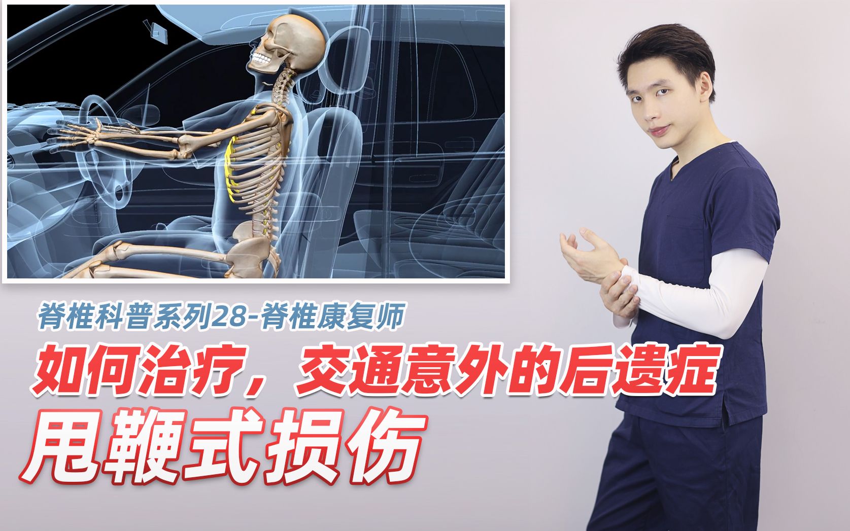 脊椎科普系列28-如何治疗,交通意外的后遗症甩鞭式伤害