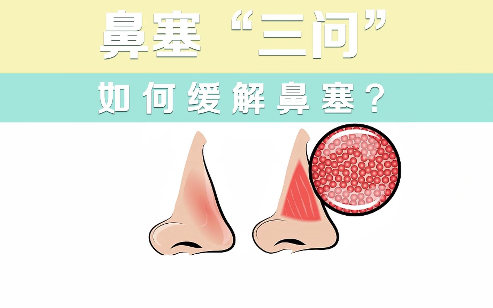 鼻塞太难受，如何缓解？试试这三招