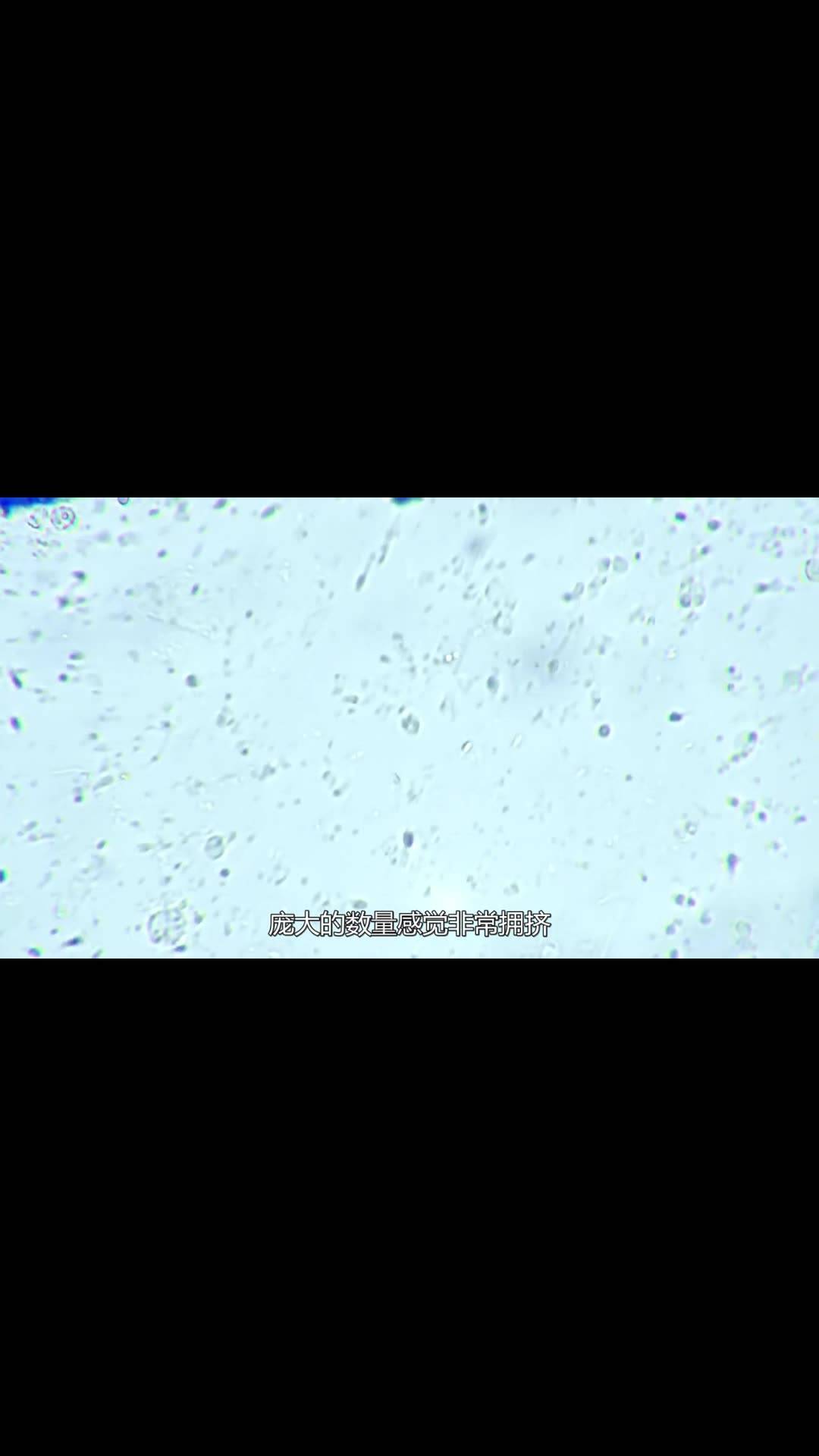显微镜下的世界是什么样的,这看着太神奇了