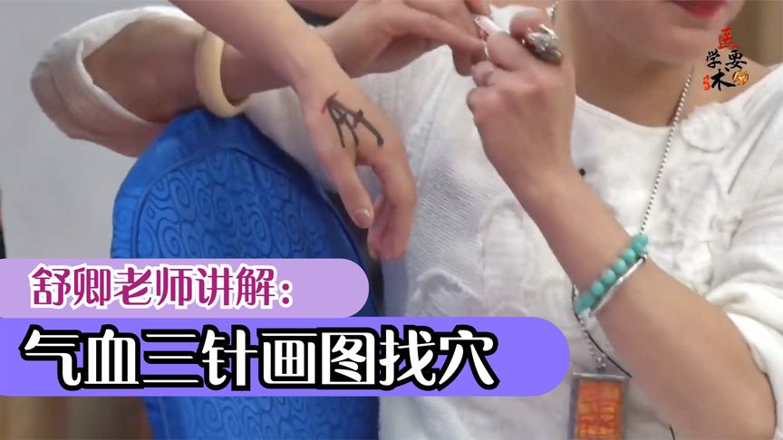 舒卿:气血三针怎样找穴,画图来给你讲解