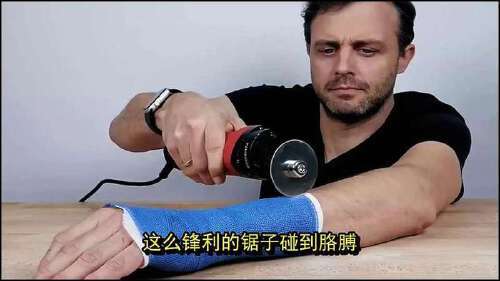 心脏支架手术全程实拍,血管"撑开"瞬间太震撼!