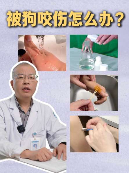 被狗咬伤的正确处理方法!#涨知识 #医学科普 #狂犬病 #抖出健康知识...
