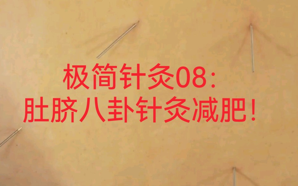 极简针灸08:肚脐八卦针灸瘦大肚子!