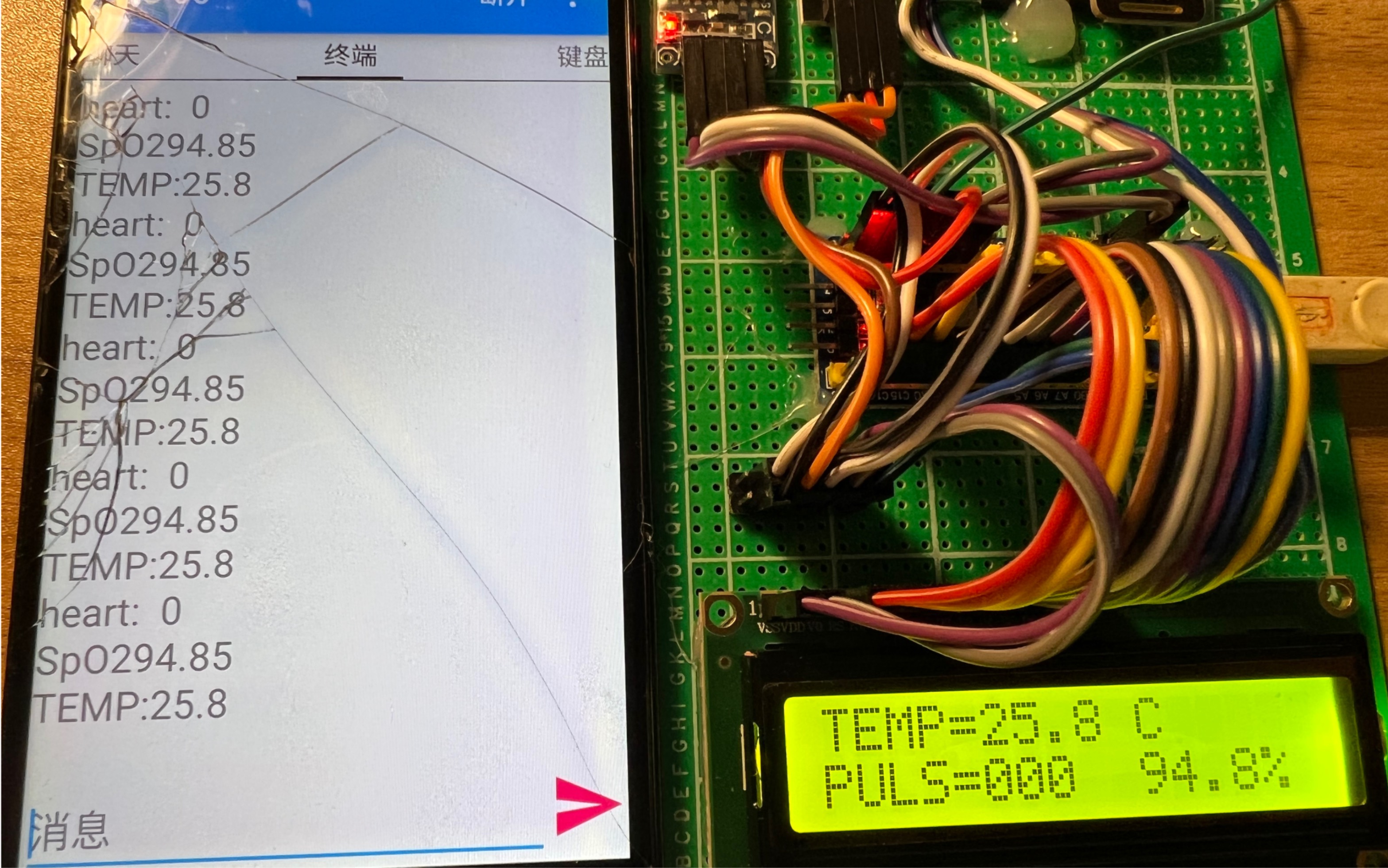 61-基于stm32单片机心率体温检测LCD1602显示蓝牙上传(程序+原理...