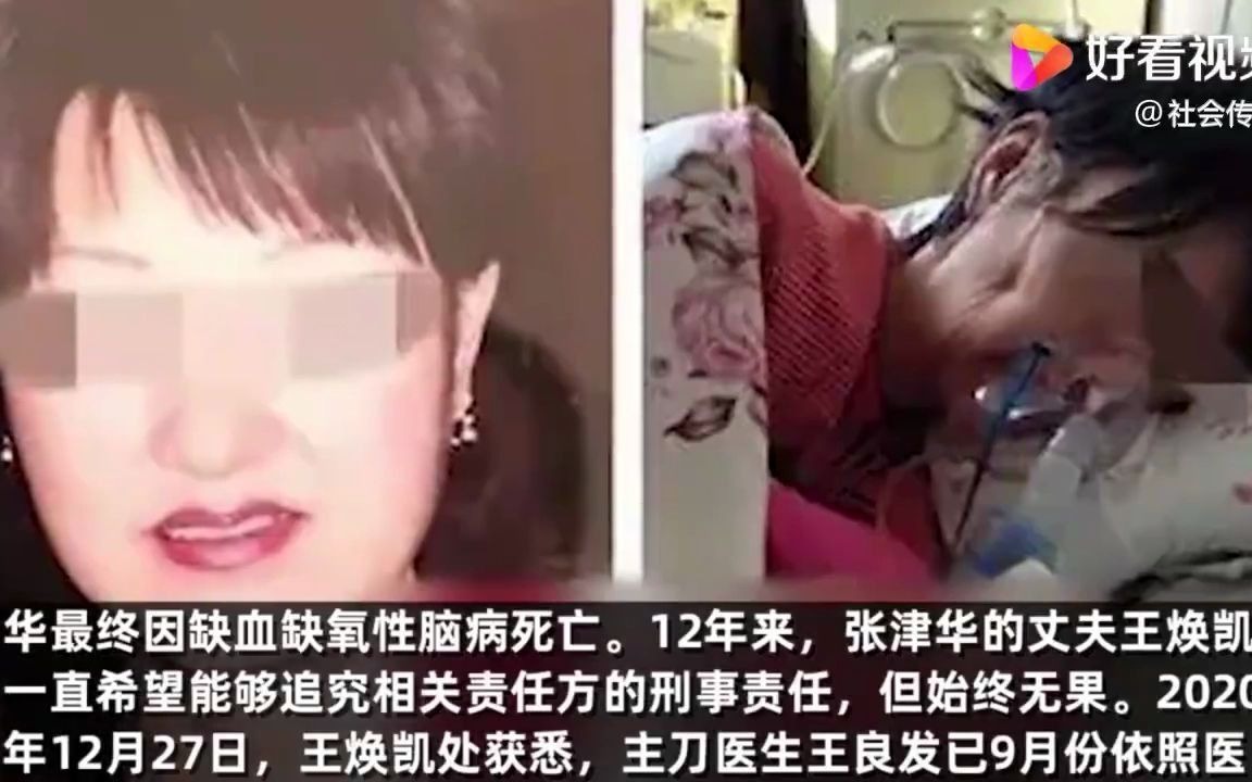 ...昏迷10年后死亡 主刀医生被批捕】女子抽脂减肥成植物人10年后死亡