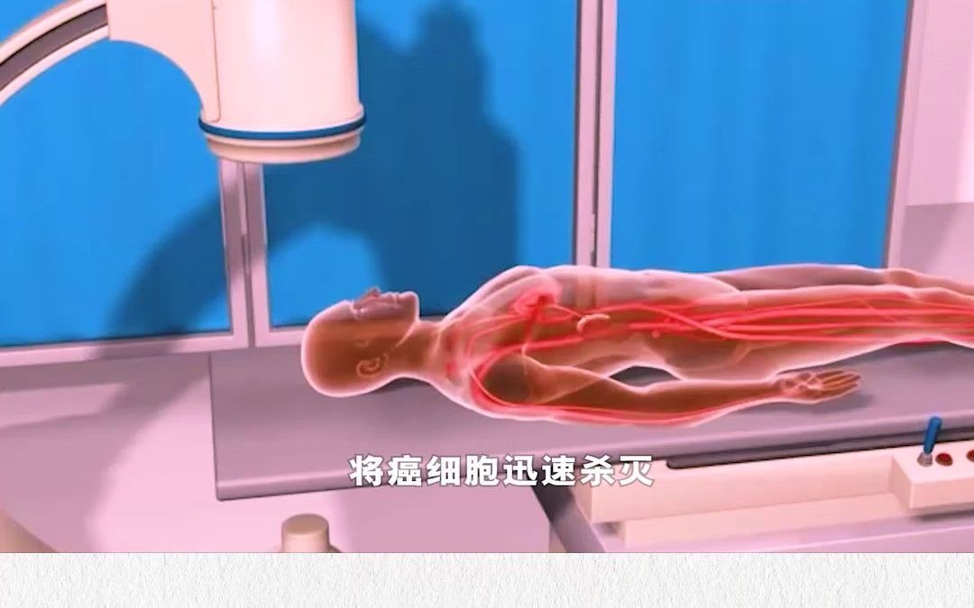 动画科普之微血管介入治疗肿瘤
