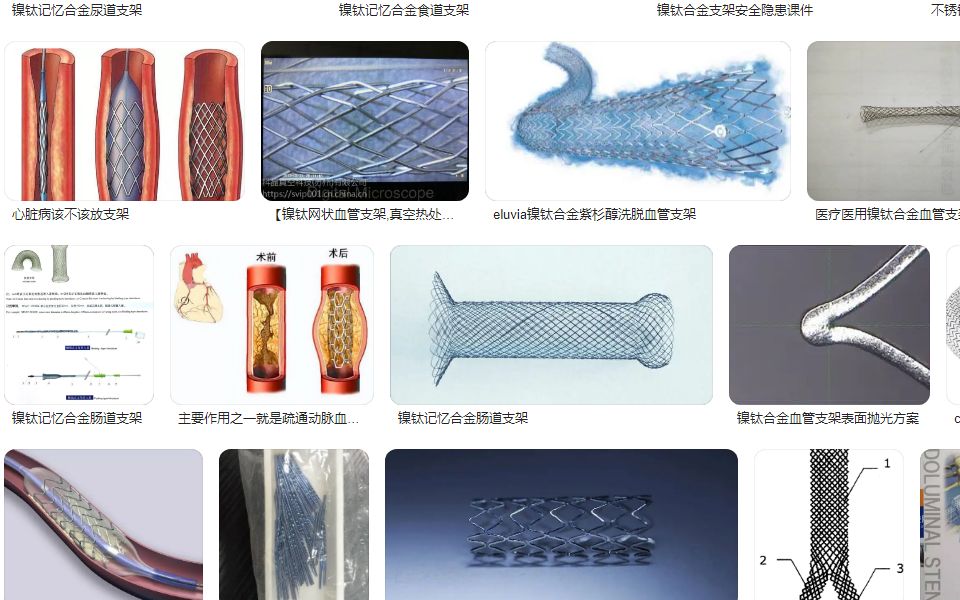镍钛合金 血管支架ANSYS仿真 Best Practices Homework