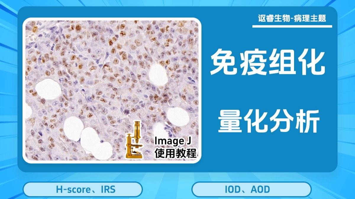 一篇就够!掌握Image J科学量化IHC染色(含批量化处理)