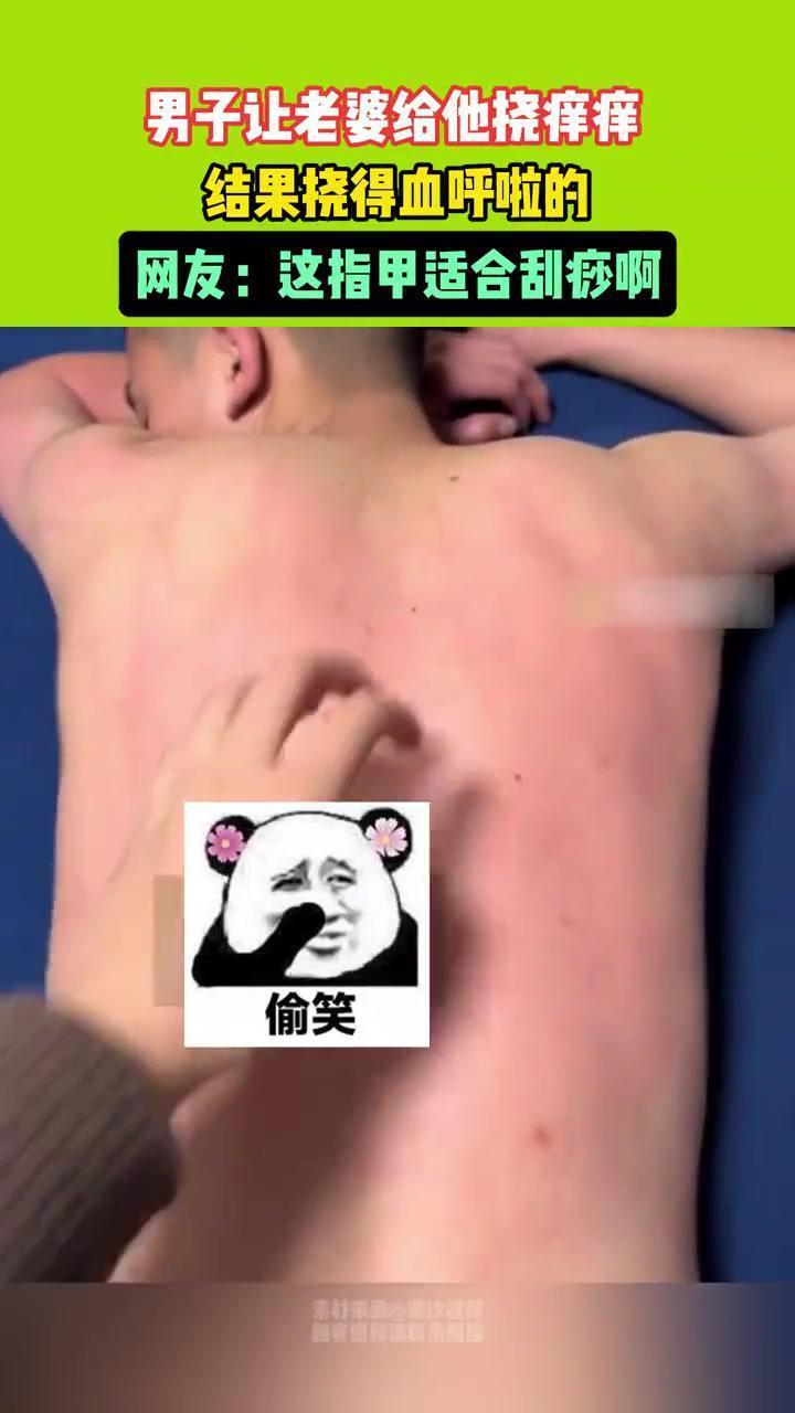 男子让老婆给他挠痒痒结果挠的血呼啦的