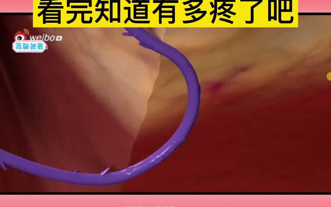 伤口缝合,看完扎心的疼1