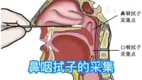 鼻咽拭子采集技术