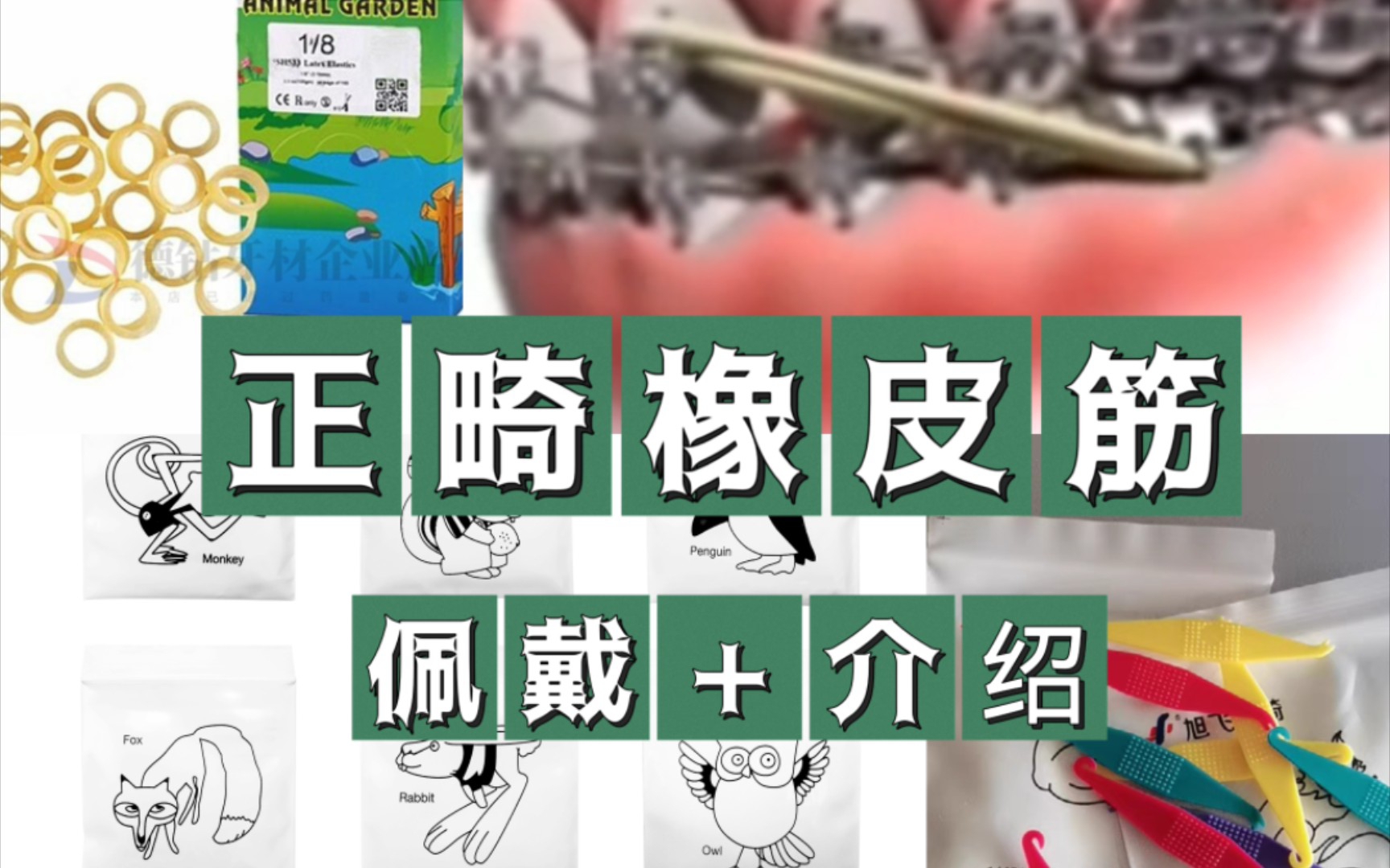 [正畸橡皮筋]如何佩戴|牙套怎么挂皮筋|动物皮筋|颌间牵引|佩戴方式|...