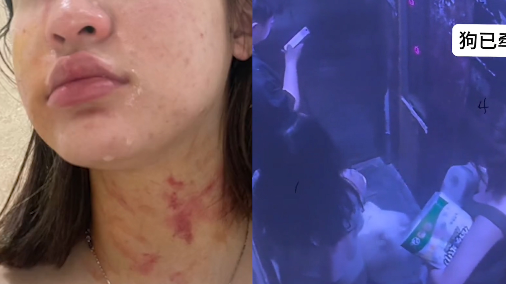 女子称牵狗进电梯遭邻居殴打后续:现改口道歉,账号已设置为私密