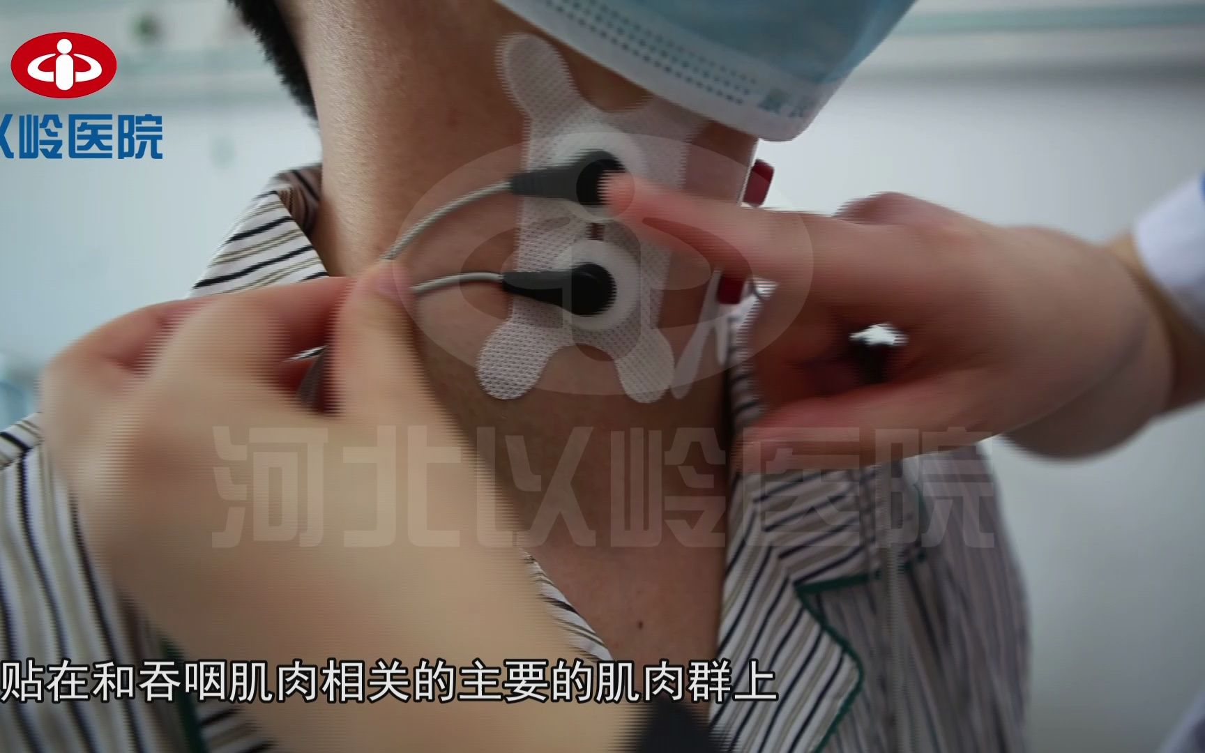 吞咽困难治疗仪在治疗肌肉萎缩过程中的应用