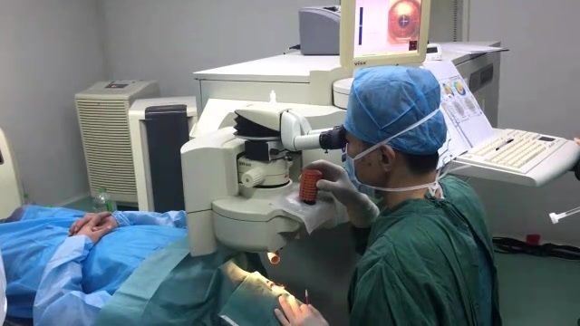 实拍飞秒激光近视手术全过程