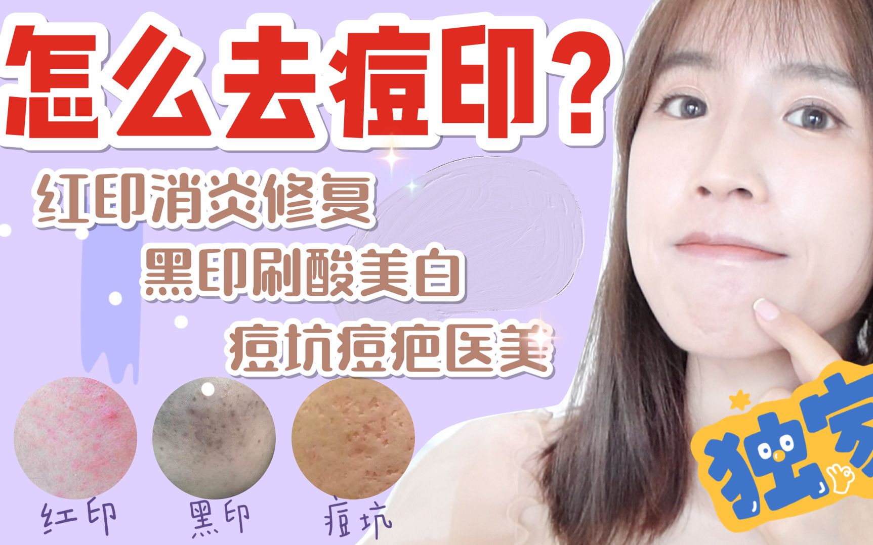 20块起!十年痘印橡皮擦,学生党必备!❤️红印消炎修复同时上 ♠️黑...