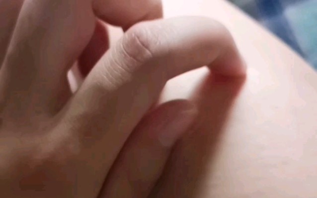 沉浸式挠痒痒之—— 一时之间不知道哪个疙瘩更痒