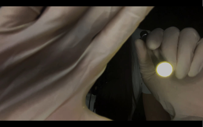 【九月助眠】超困的灯光视觉催眠|模拟医生为你检查眼睛