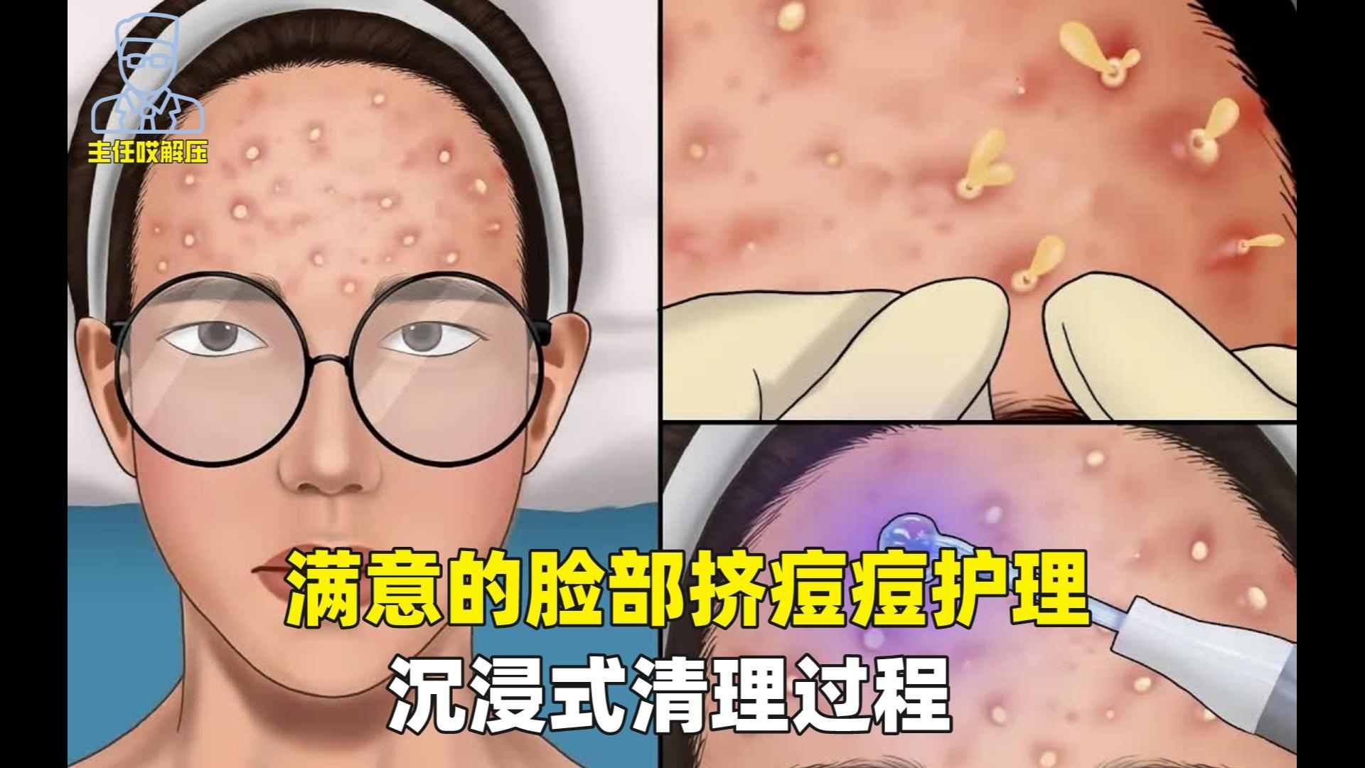 解压动画,令人满意的脸部清洁护理,沉浸式清理过程