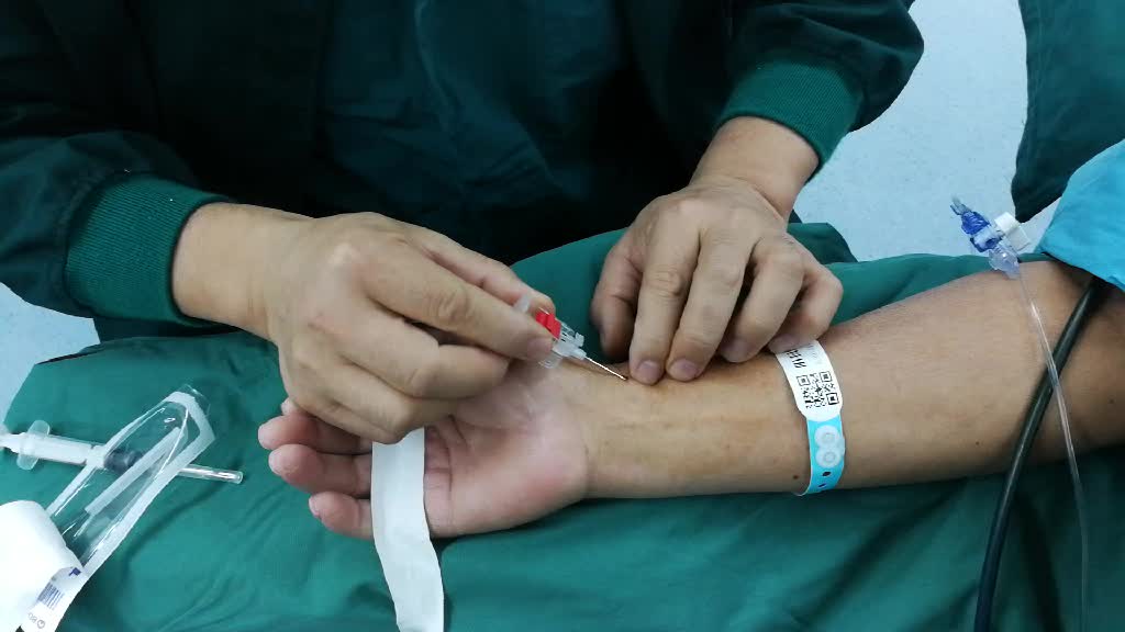 穿透法动脉穿刺置管,周末愉快,