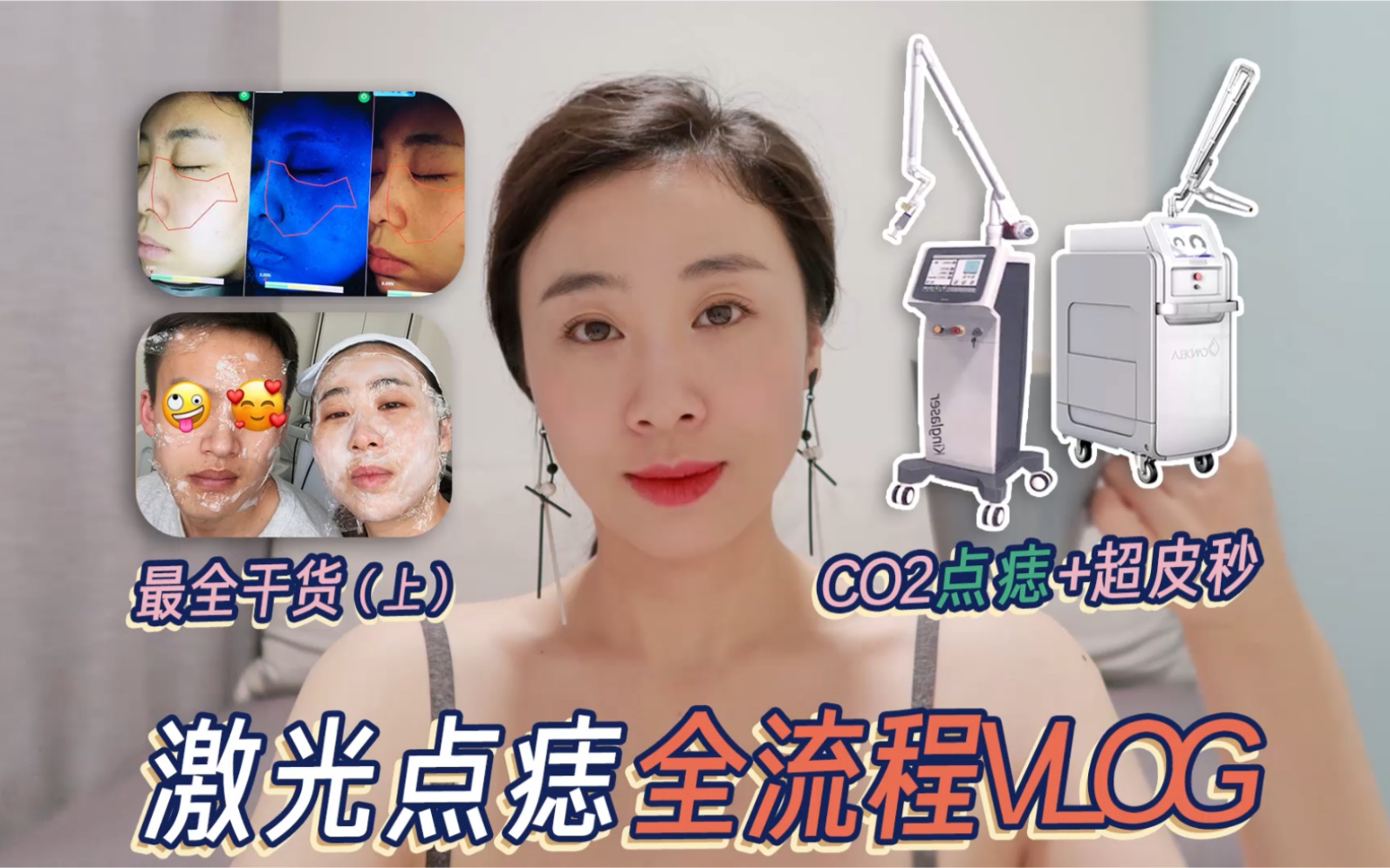 点痣和超皮秒全流程!激光点痣是什么体验?