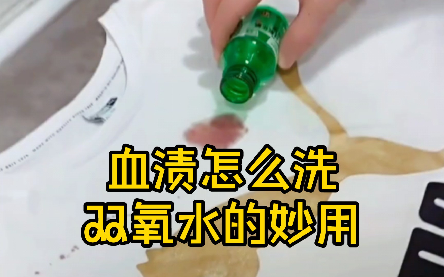 双氧水的妙用,衣服上的血渍清洗妙招