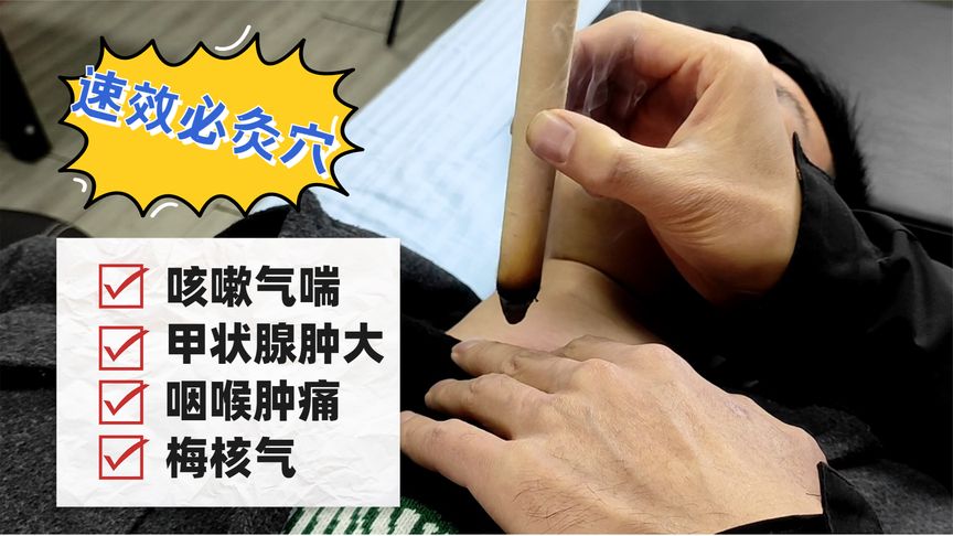 天突穴艾灸实操:善调甲状腺结节,咳嗽气喘,咽喉肿痛,梅核气