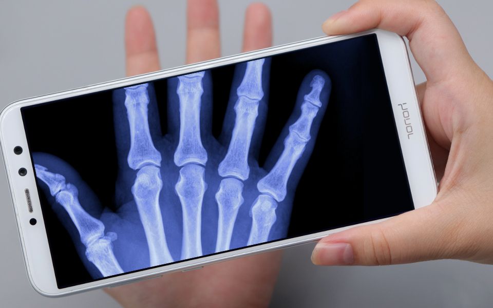 原来手机还有“透视”功能,手上的骨头都能清晰看到,太厉害了