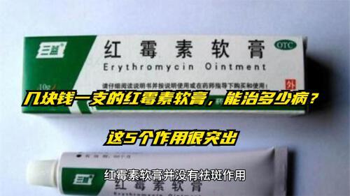 几块钱一支的红霉素软膏,能治多少病?这5个作用很突出