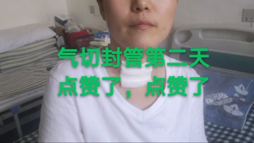 气切封管第二天,点赞了