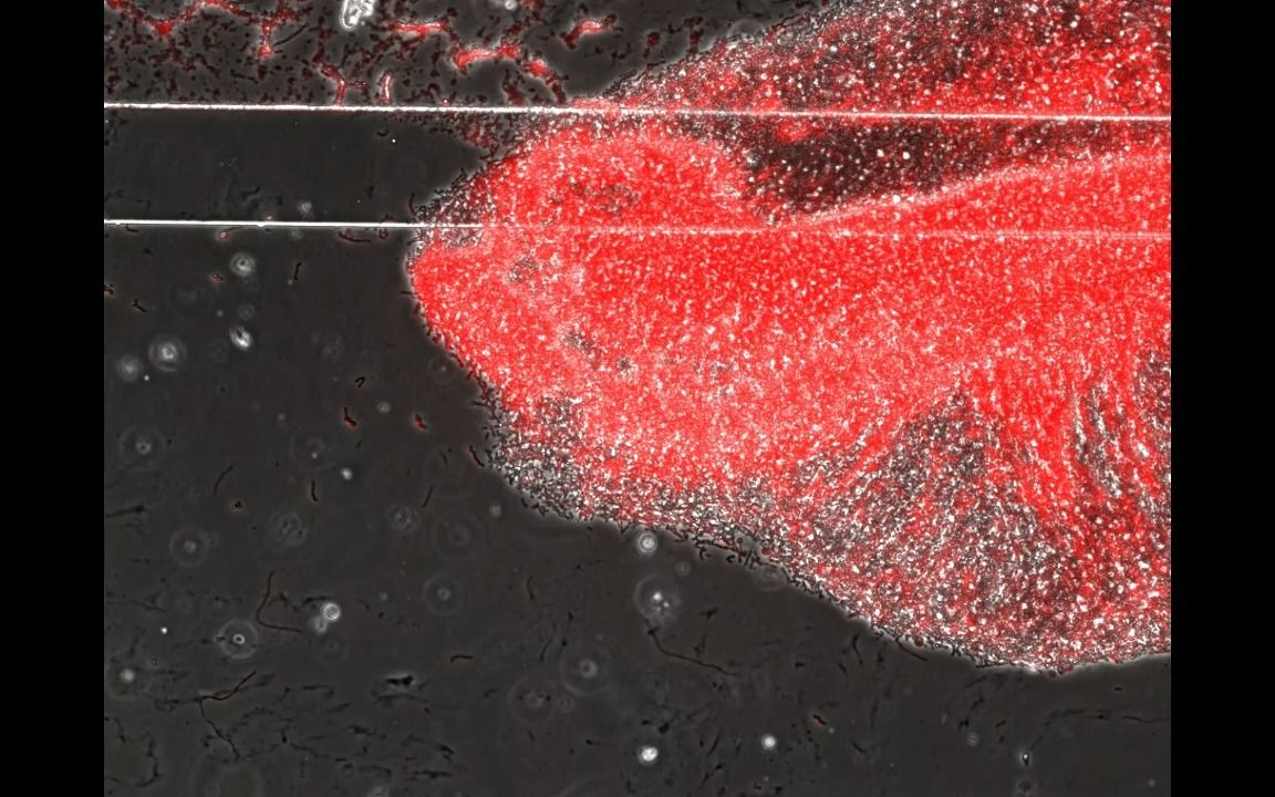 科研小确幸第九弹~显微镜下的菌落生长