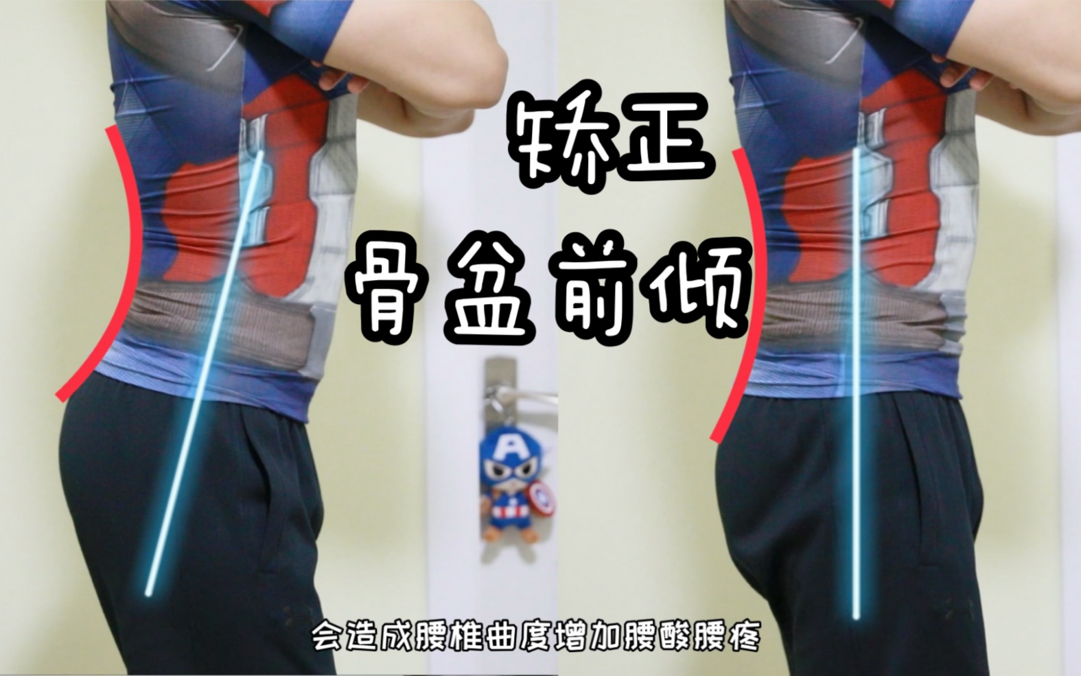 真正改善【骨盆前倾】就这么简单!
