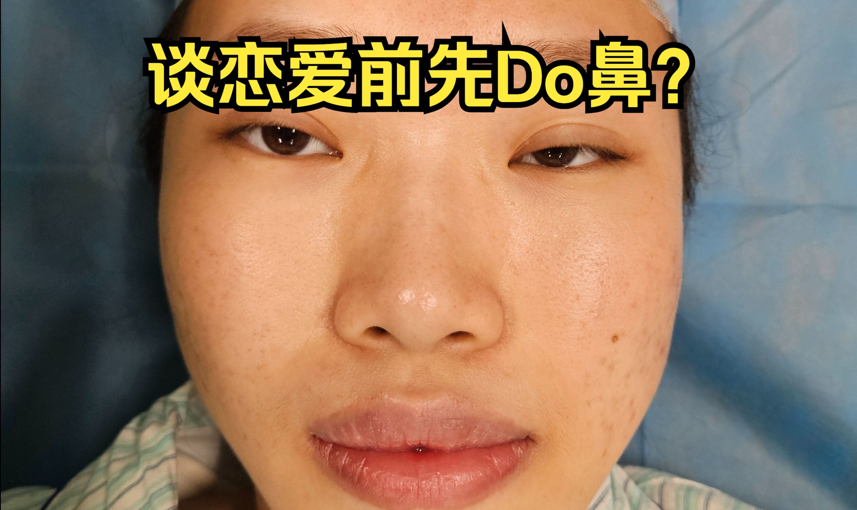 专业解说:鼻整形手术的全过程和术后恢复!