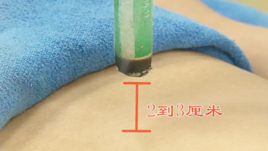 传统中医治疗遗精泄泻的方法 照着视频学就能做