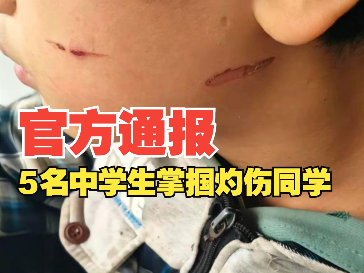 四川官方通报5名中学生掌掴灼伤同学