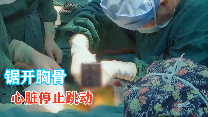 心脏手术真实现场!锯开胸骨后,医生竟让心脏停止跳动