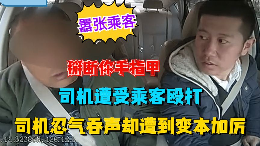 司机遭受乘客殴打,司机忍气吞声却遭到变本加厉:掰断你手指甲!