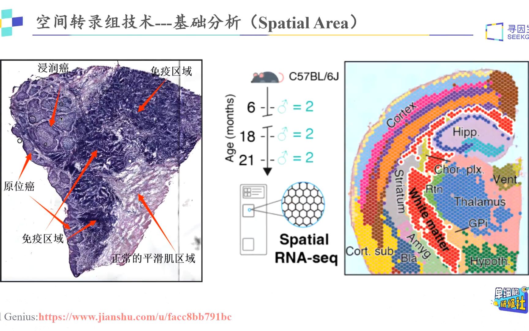 空间转录组高级个性化数据分析第一期