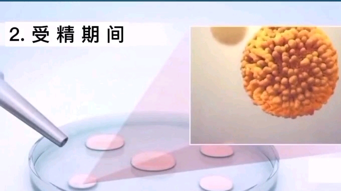 第三代试管婴儿移植全过程,做试管疼不疼,一个视频告诉你。