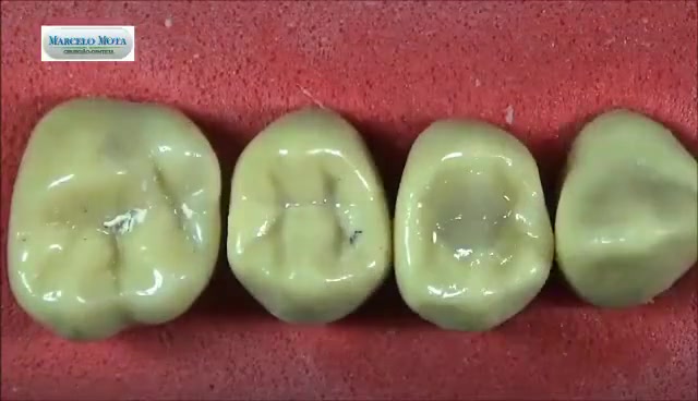 种植牙全过程,了解一下。