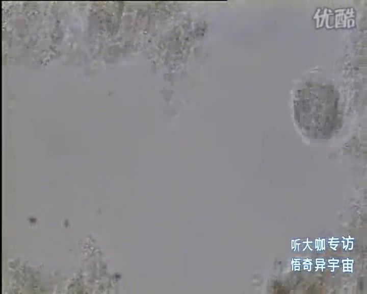 【转载】显微镜下的细菌