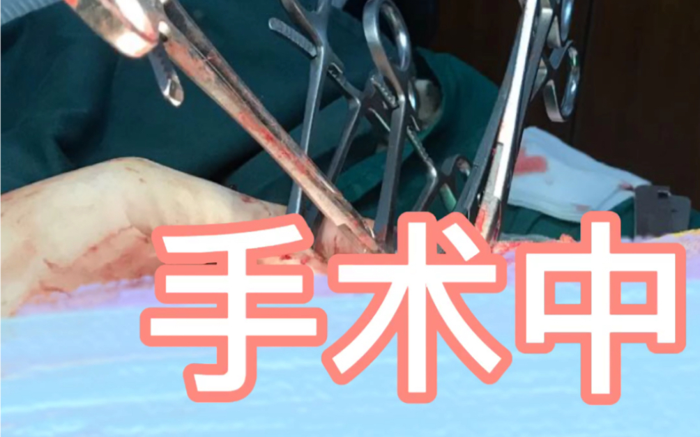 狗狗桡尺骨骨折内固定