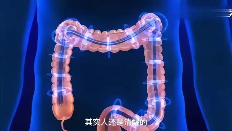 长沙东大健康小视频:看看普通肠镜是怎么做的