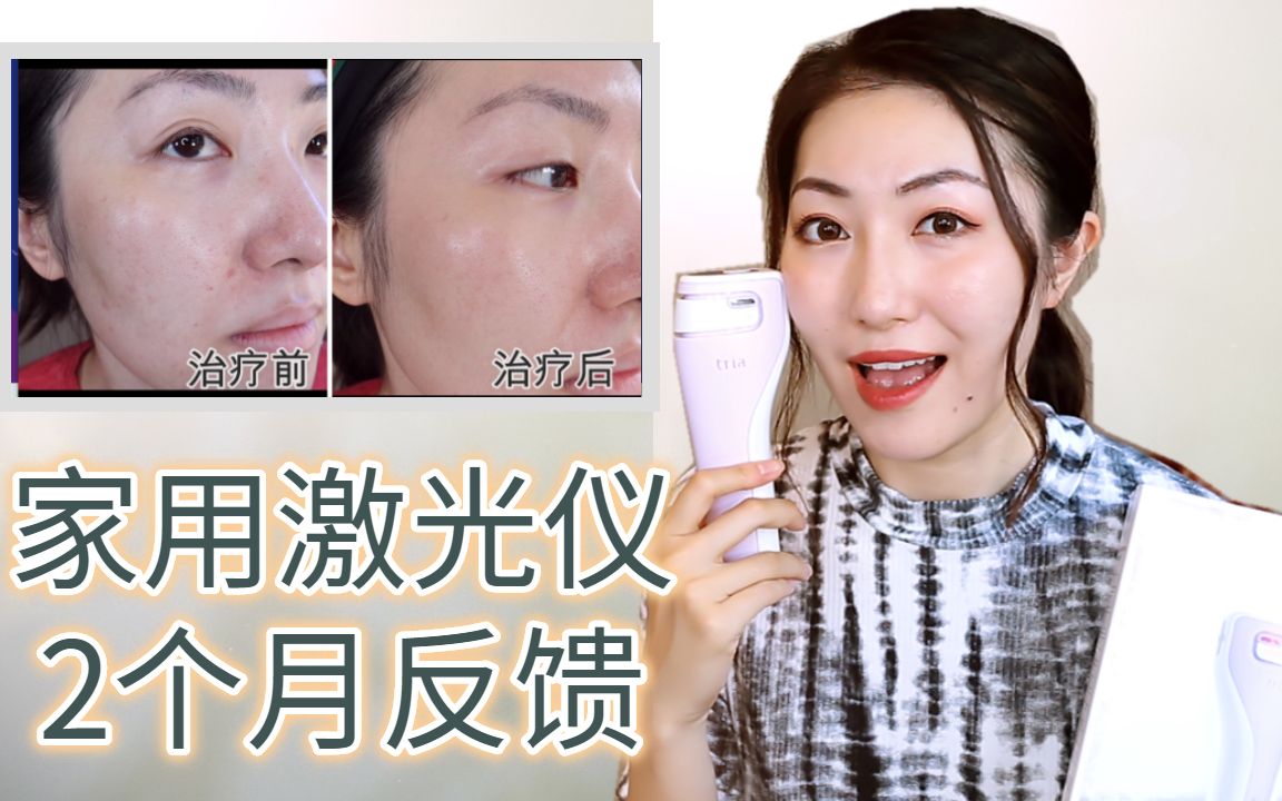 痘疤斑点毛孔有救了!TRIA家用点阵激光仪全攻略心得示范