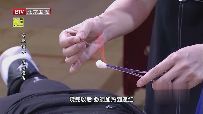 中医减肥有高招!火针疗法,逆转瘦不了的虚胖体质~