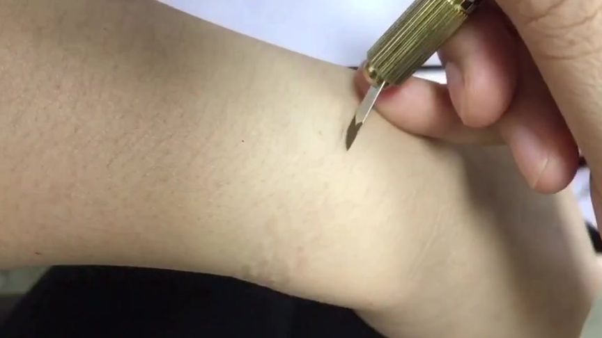 这次讲解重点是排针手法