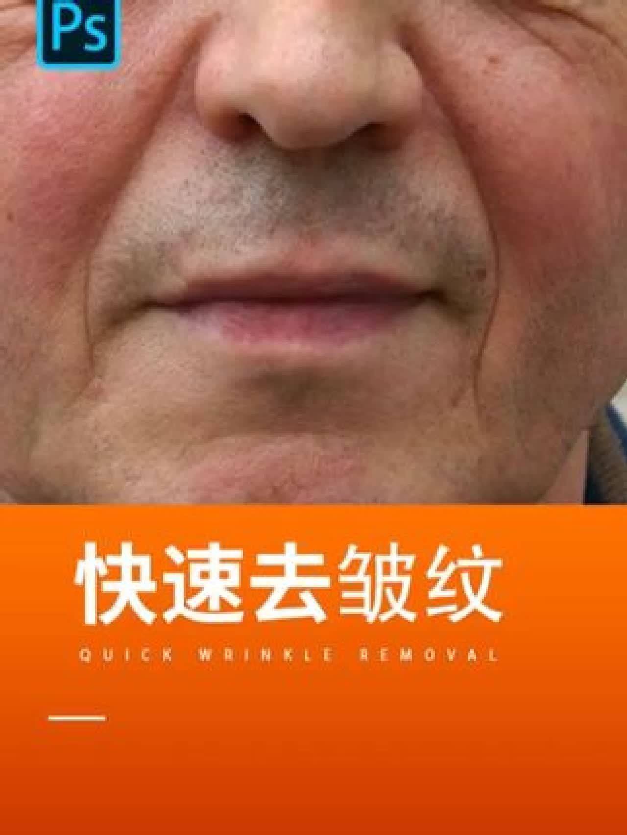 快速去皱纹,这是人物精修哦,是不是感觉自然很多了呢 快速去皱纹,这是...