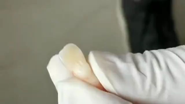 牙科“抽牙神经”过程,钻牙根管治疗!